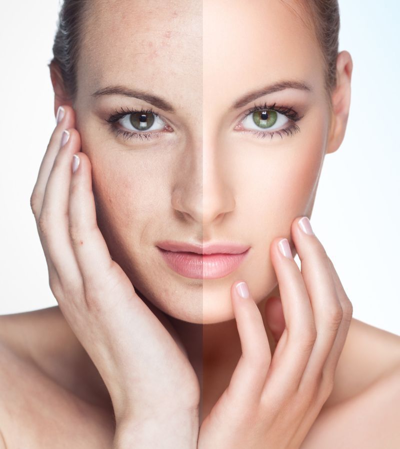 How frequently should I be receiving facials? | Richmond, VA